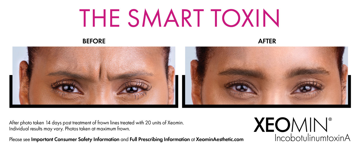 What Is Xeomin? | Anti-Aging Solution | BG Medical Aesthetics